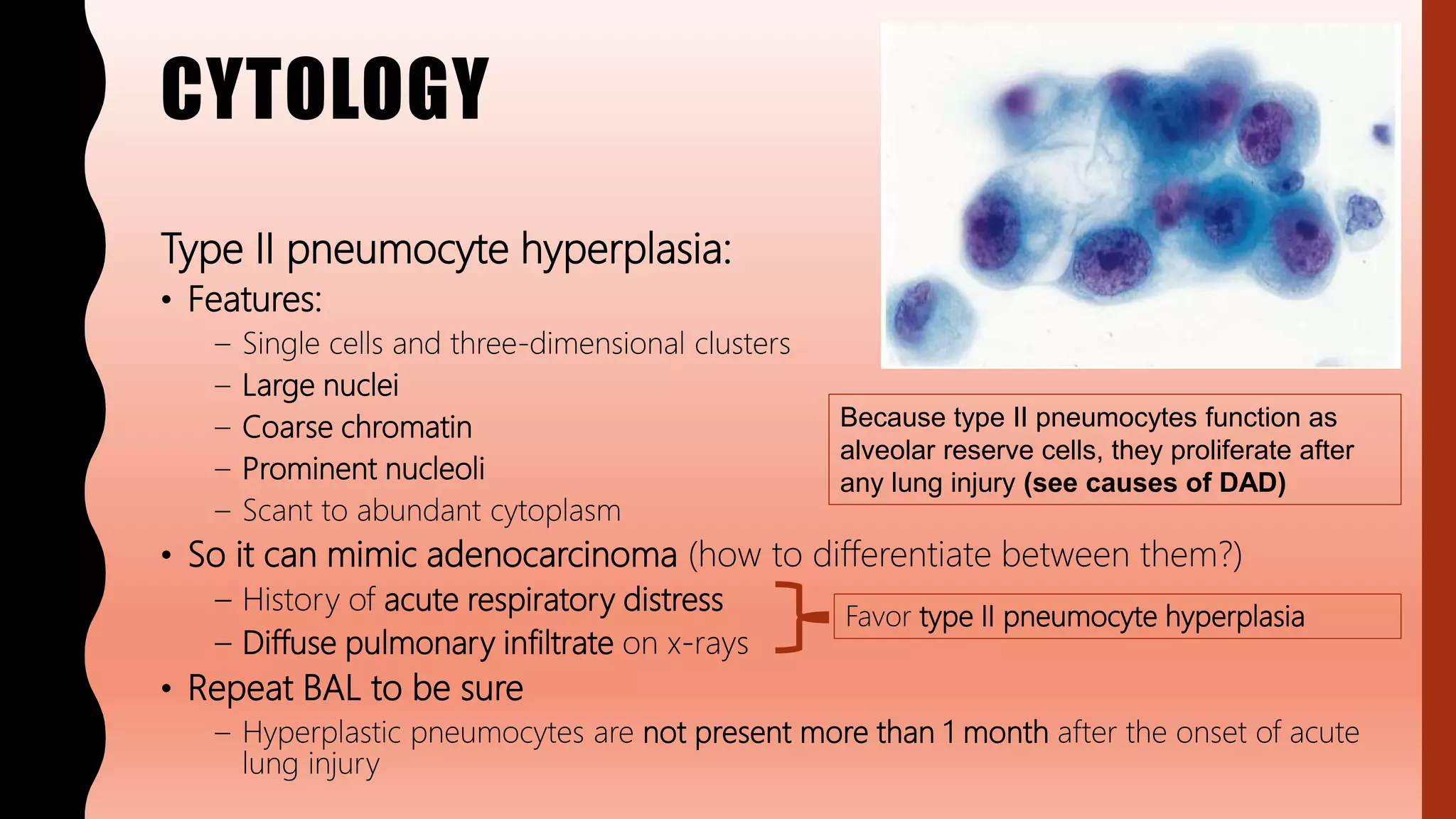 FlashPath - Lung - Cryptogenic Organizing Pneumonia (Bronchiolitis ...