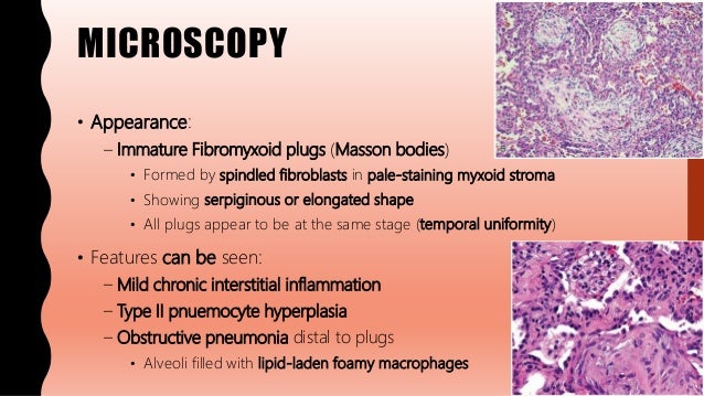 FlashPath - Lung - Cryptogenic Organizing Pneumonia (Bronchiolitis Ob…