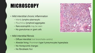 FlashPath - Lung - Desquamative Interstitial Pneumonia | PPT