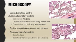 FlashPath - Lung - Diffuse Panbronchiolitis | PPT
