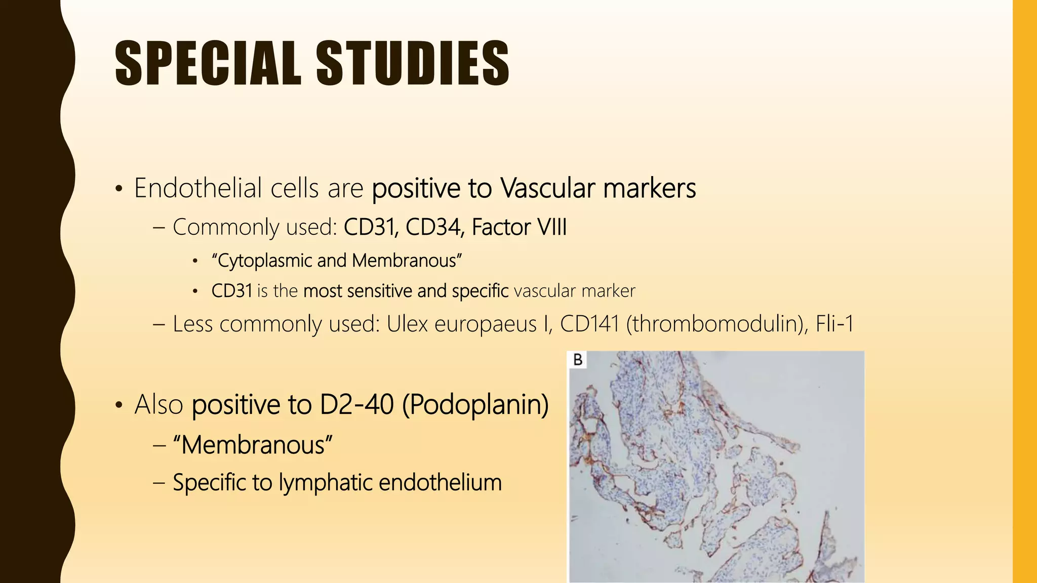 FlashPath - Lung - Diffuse Pulmonary Lymphangiomatosis | PPTX
