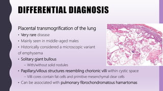 FlashPath - Lung - Emphysema | PPTX