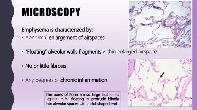 FlashPath - Lung - Emphysema