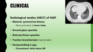 FlashPath - Lung - Nonspecific Interstital Pneumonia | PPT