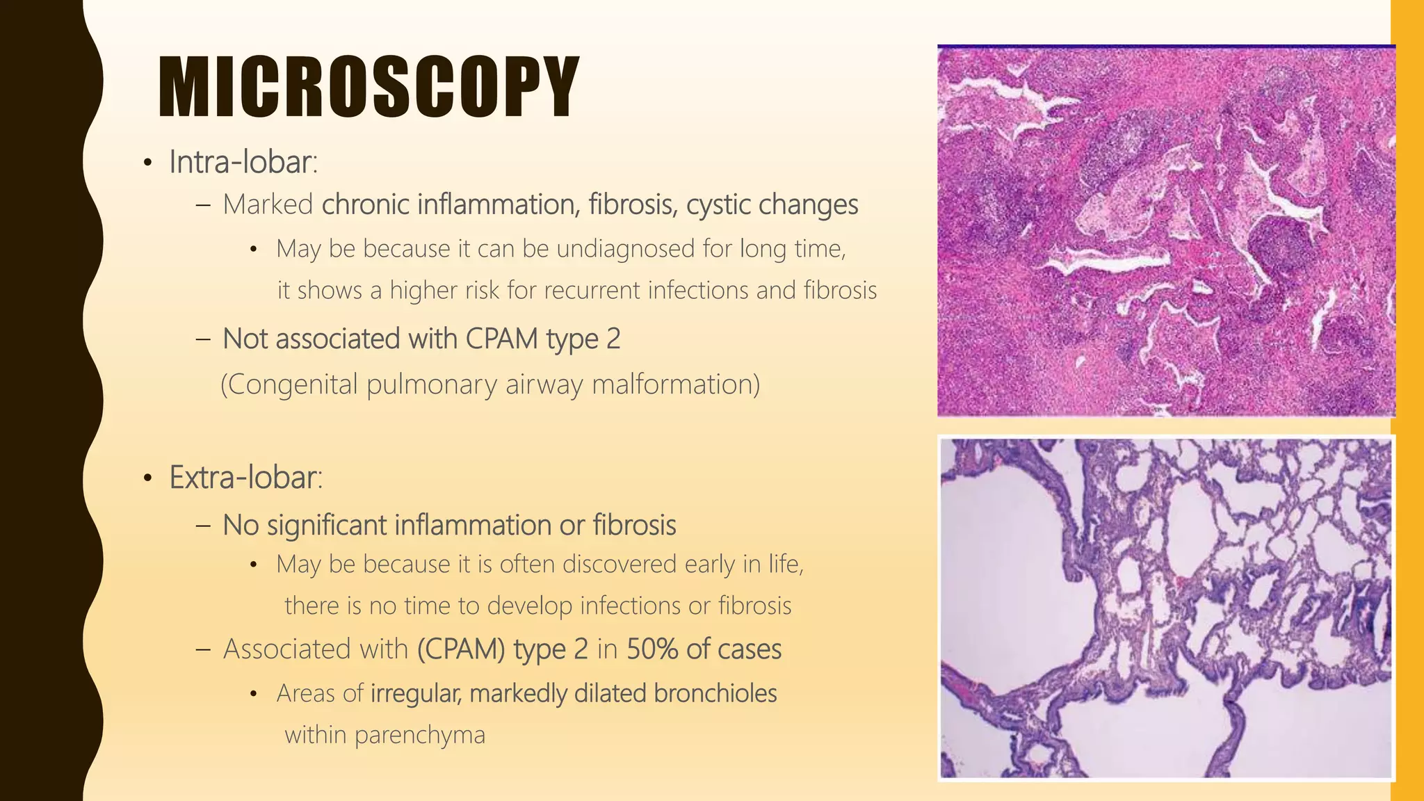 Flashpath - lung - pulmonary sequestration | PPTX