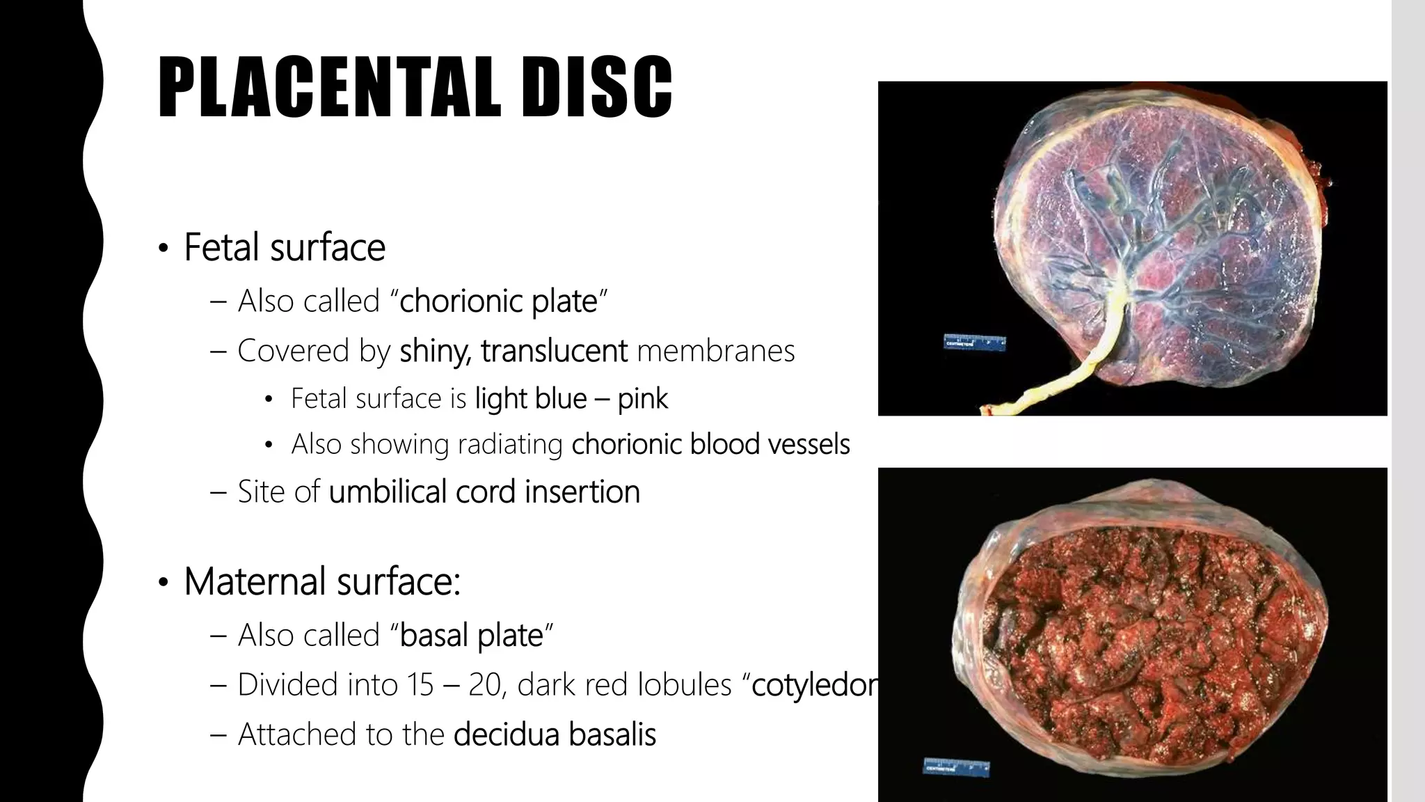 FlashPath - Placenta - Anatomy | PPTX