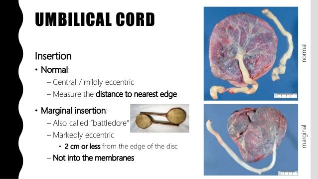 FlashPath - Placenta - Grossing