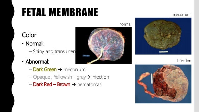 FlashPath - Placenta - Grossing
