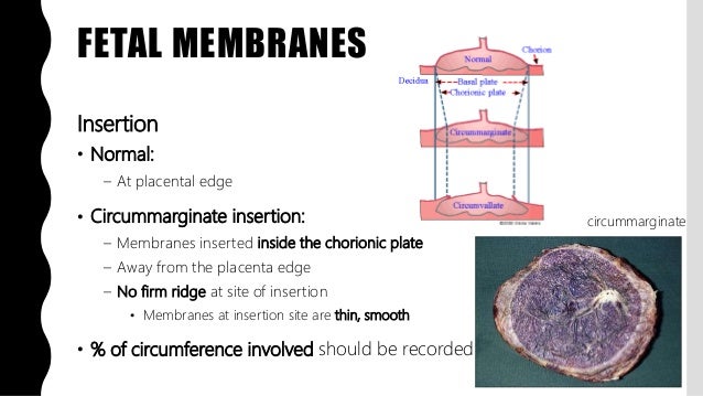 FlashPath - Placenta - Grossing