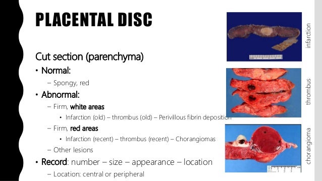 FlashPath - Placenta - Grossing