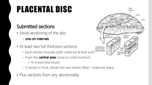 FlashPath - Placenta - Grossing