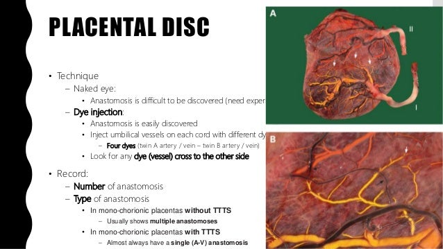 FlashPath - Placenta - Grossing