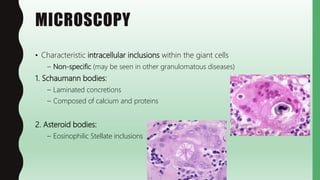 FlashPath - Sarcoidosis | PPTX