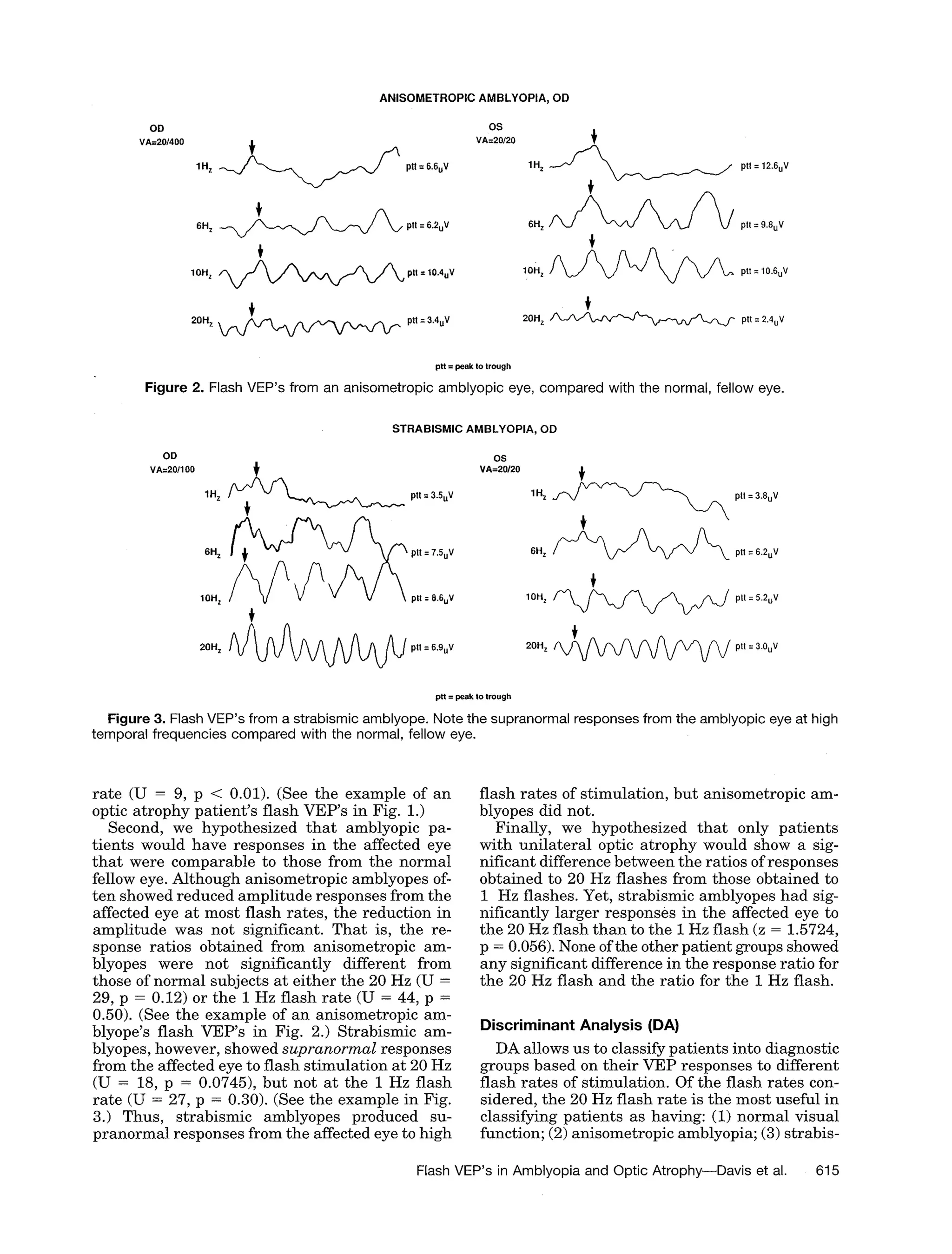 Flash visual evoked_potential__vep__in_amblyopia.4 | PDF