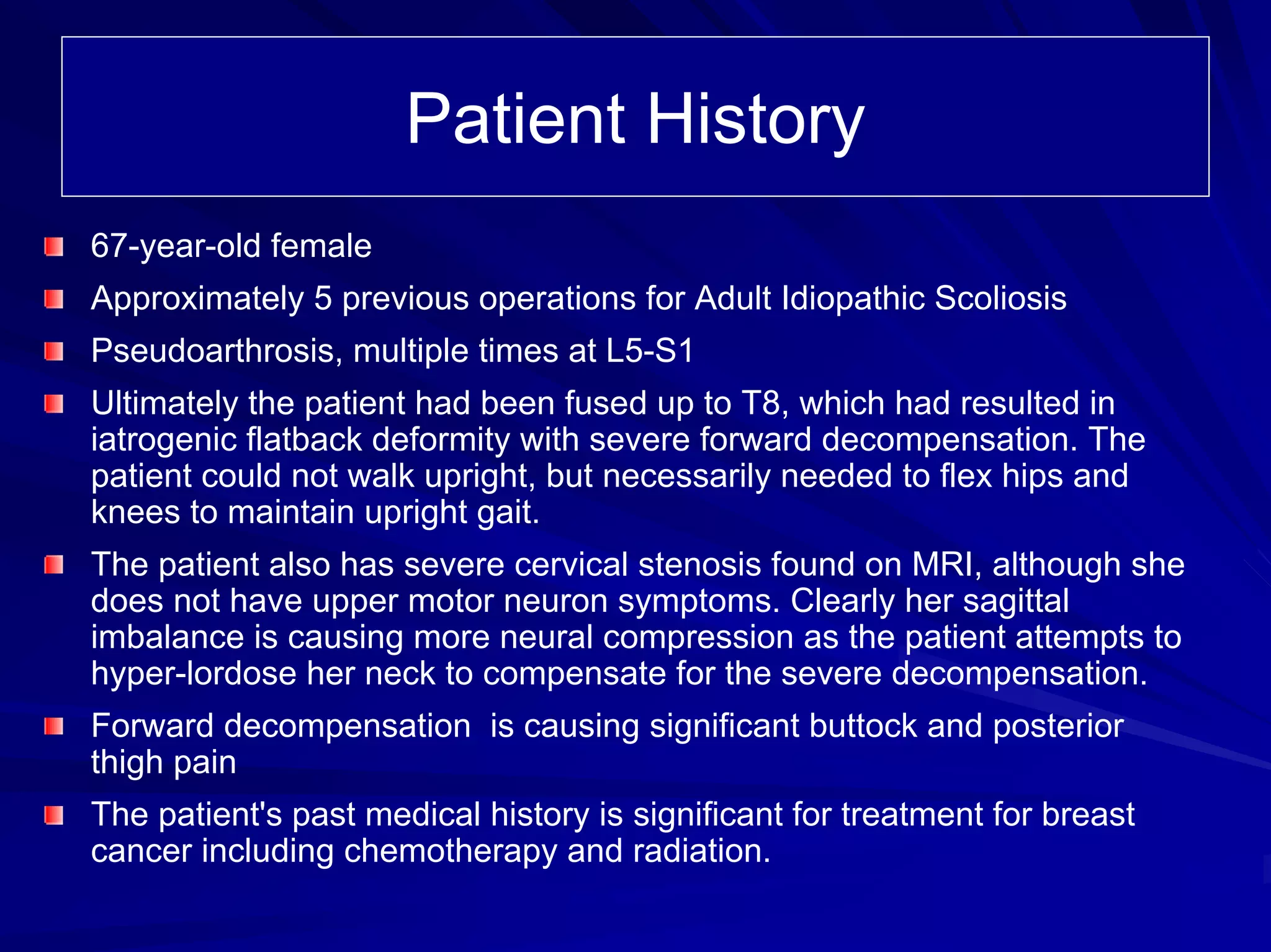 Case Review #5: 67 year old woman with flatback syndrome following 5 ...