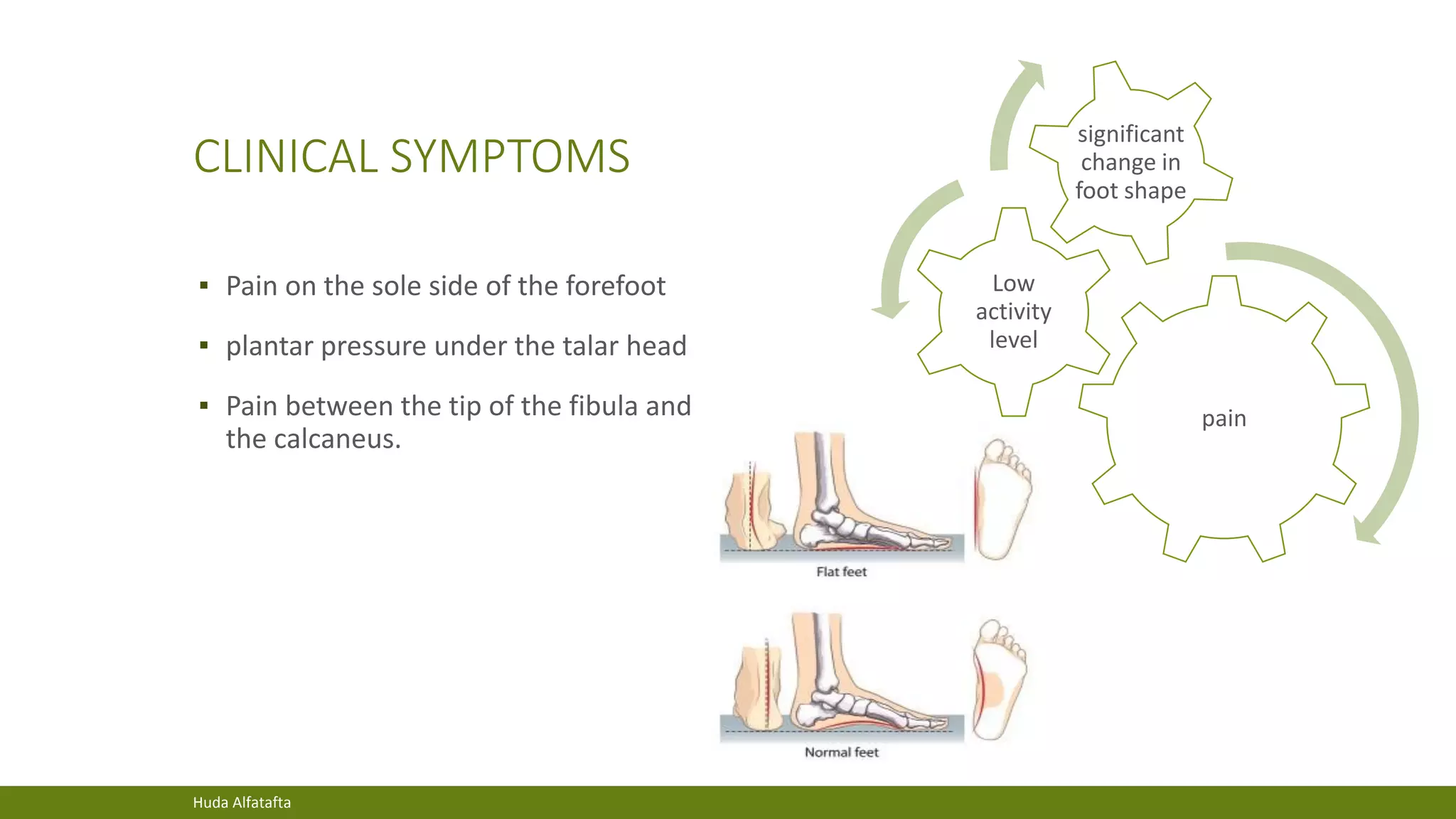 clinical examination of flat foot | PDF
