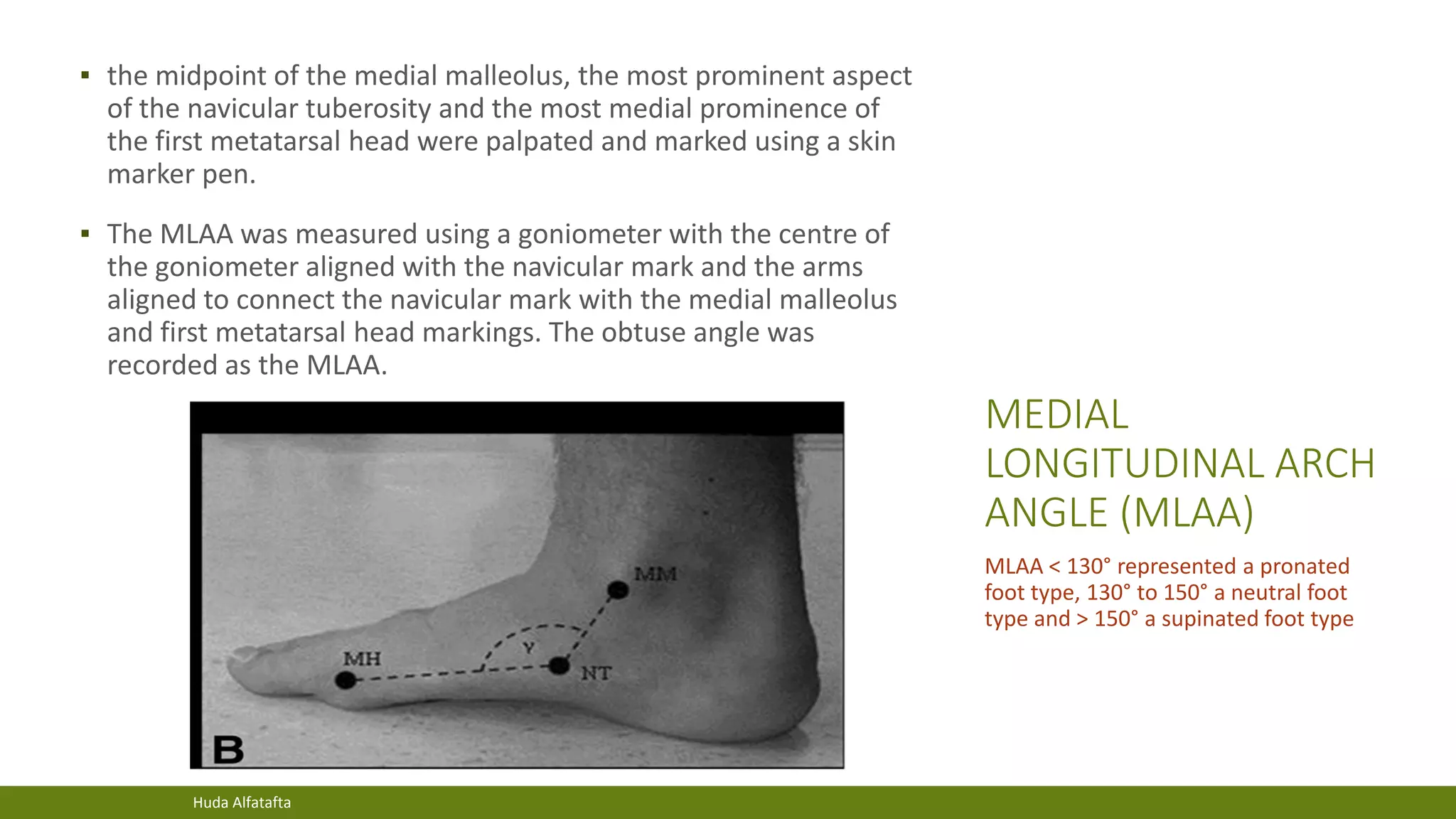 clinical examination of flat foot | PDF