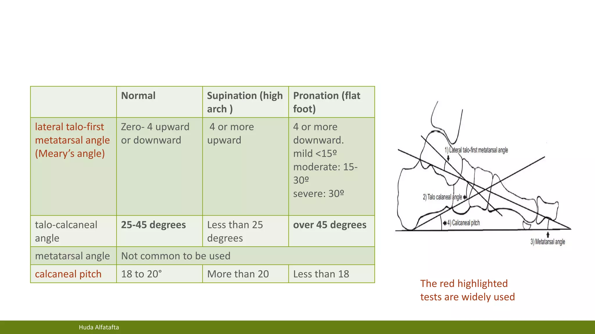 clinical examination of flat foot | PDF