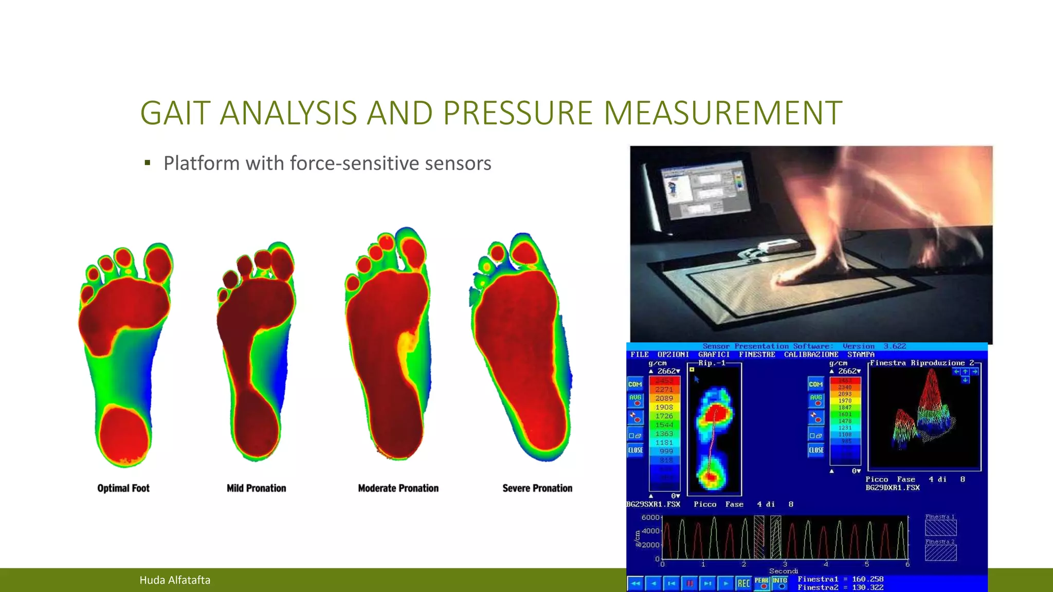 clinical examination of flat foot | PDF