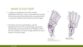 clinical examination of flat foot | PDF