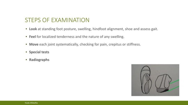 clinical examination of flat foot | PDF