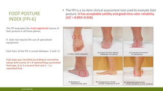 clinical examination of flat foot | PDF