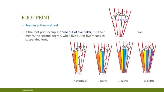 clinical examination of flat foot | PDF