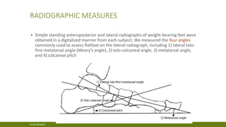 clinical examination of flat foot | PDF