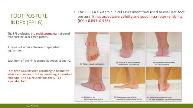 clinical examination of flat foot
