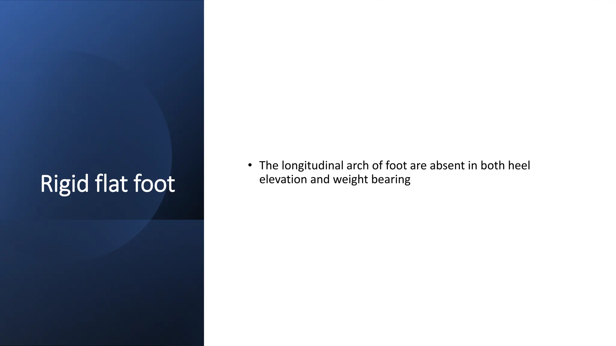flat foot.ppt [pes planus ] #physio.# rehabilitation | PPTX