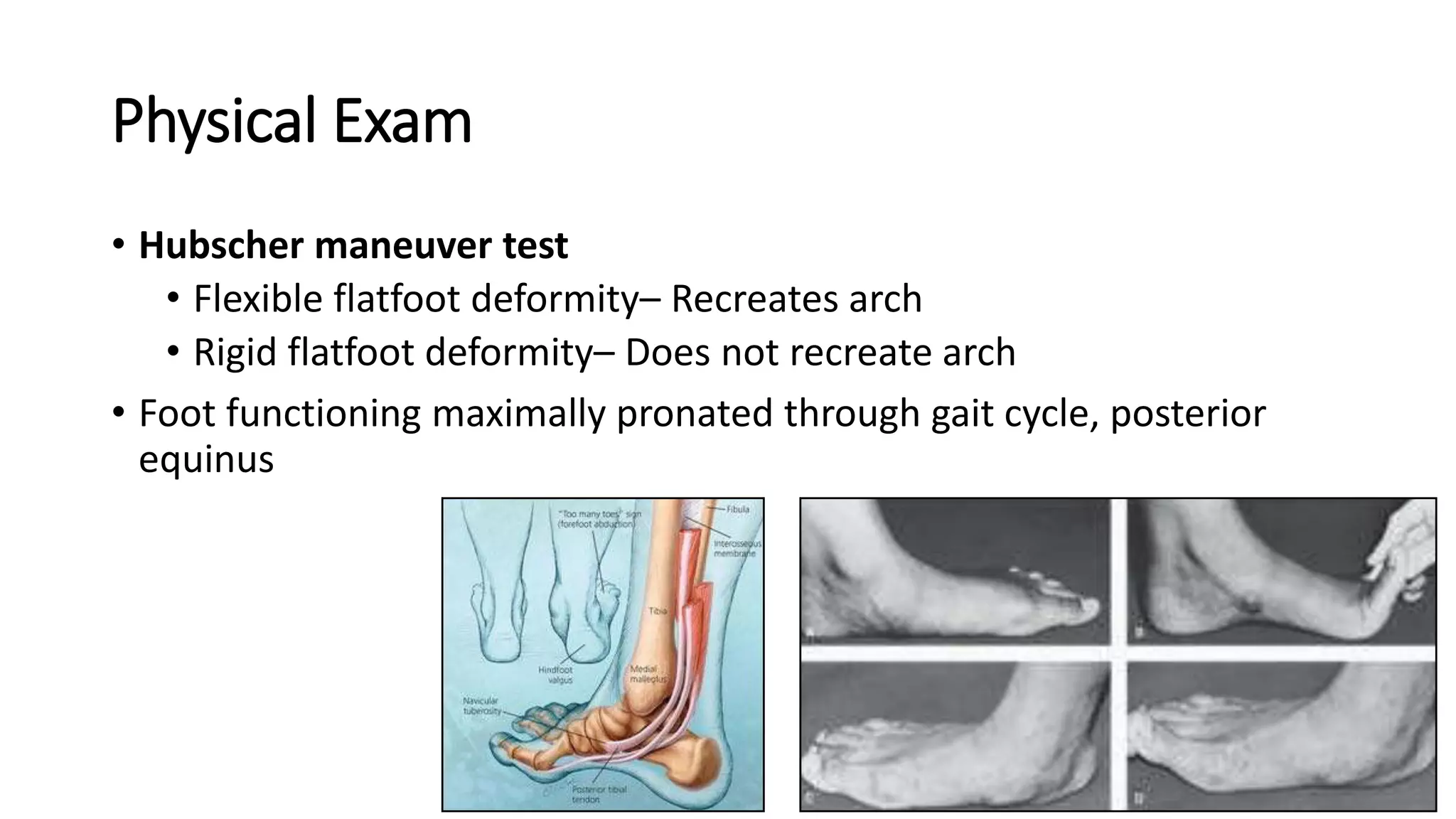 Flat foot work up | PPTX