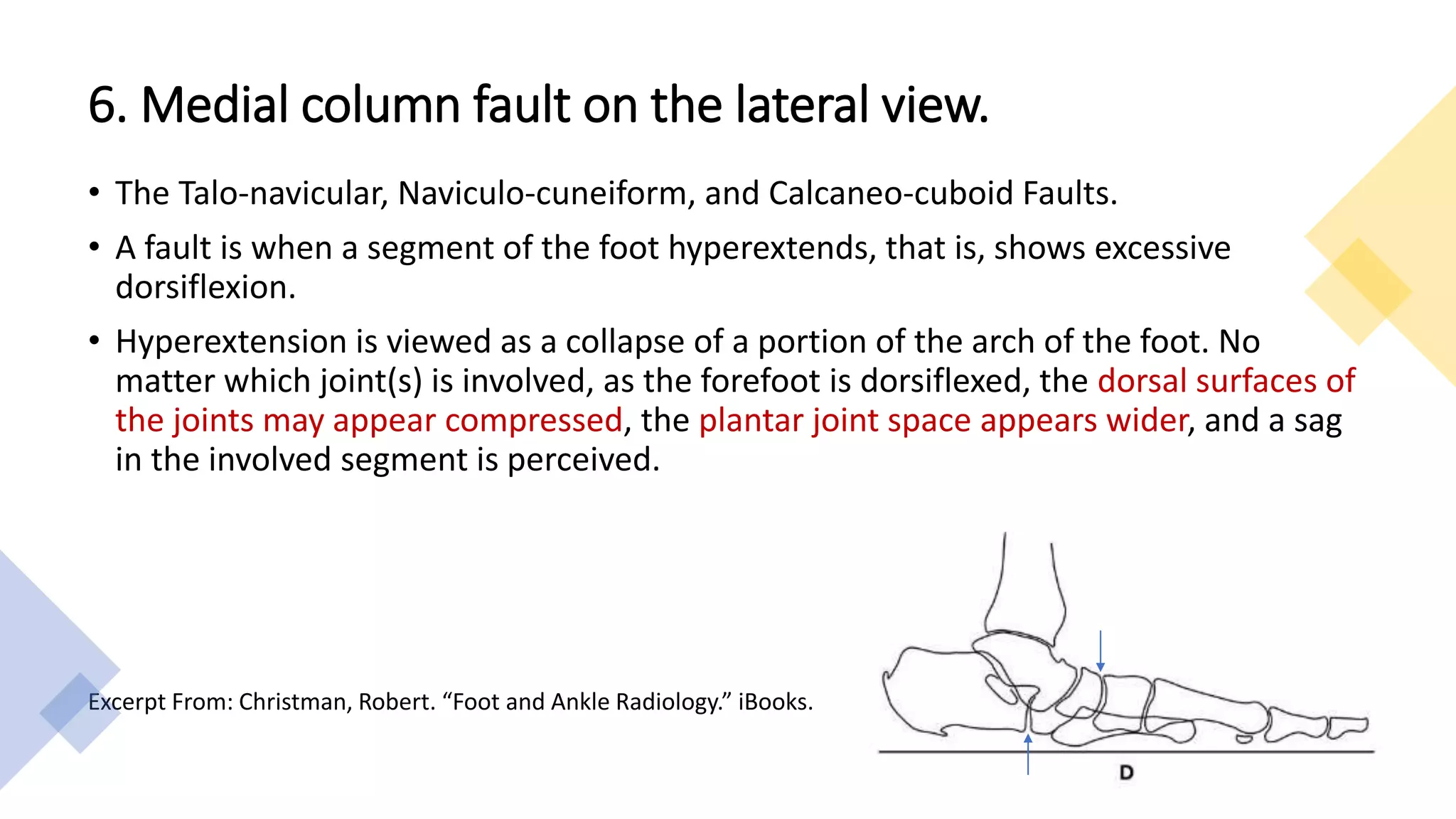 Flat foot work up | PPTX