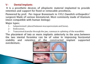 Flat ridge management | PPTX
