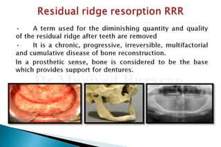 Flat ridge management | PPTX