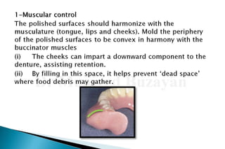 Flat ridge management | PPTX
