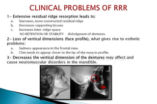Flat ridge management | PPTX