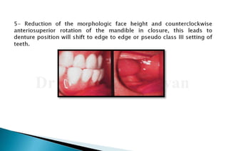 Flat ridge management | PPTX