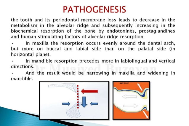 Flat ridge management | PPTX | Oral care | Personal Care