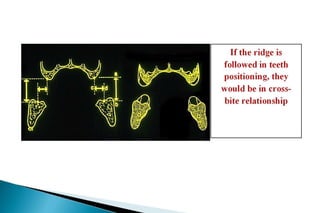 Flat ridge management | PPTX