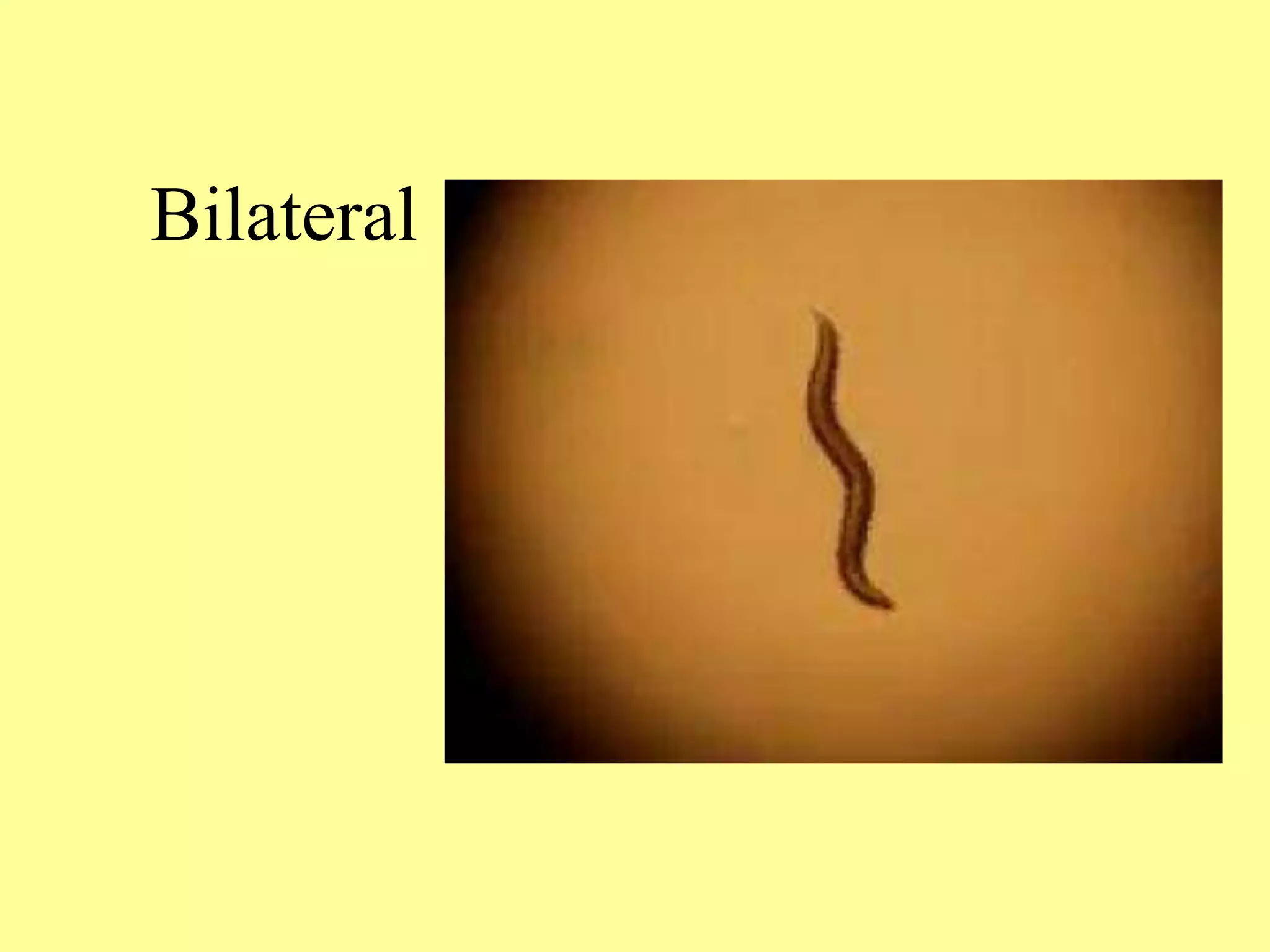 Flatworms roundworms notes | PPT | Free Download