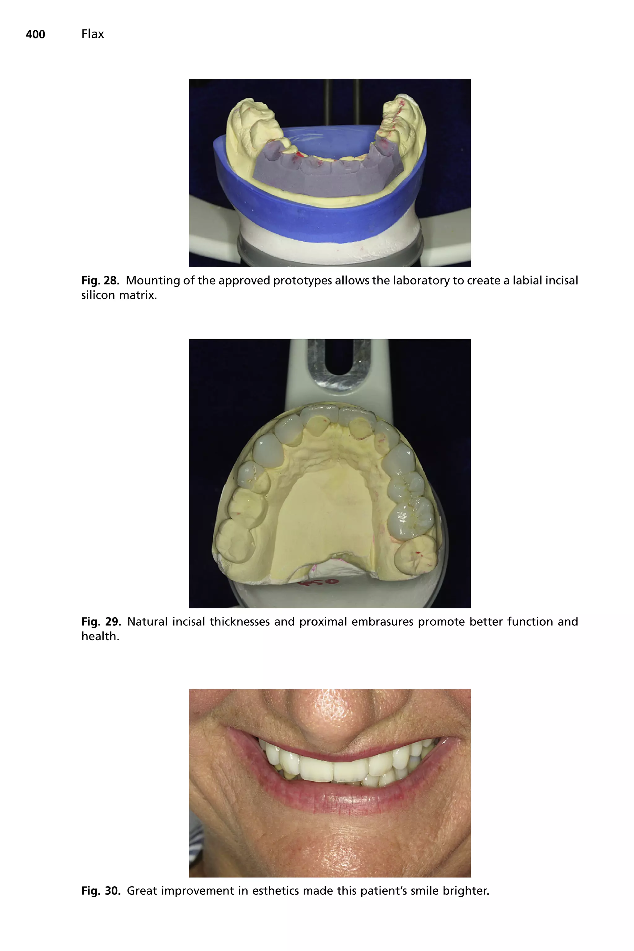 Soft And Hard Tissue Management Using Lasers | PDF