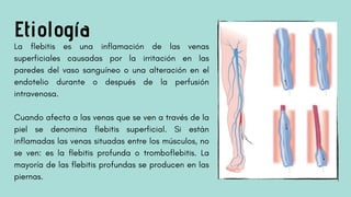 Flebitis | PDF