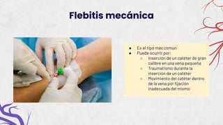 Tema de Slideshare: Flebitis. Universidad de Panamá | PDF
