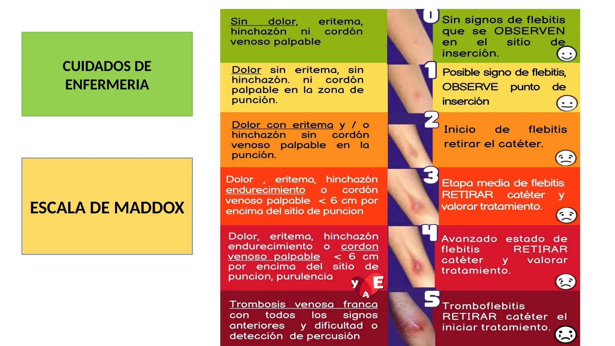 TIPOS DE FLEBITIS Y CUIDADOS DE ENFERMERÍA | PPTX