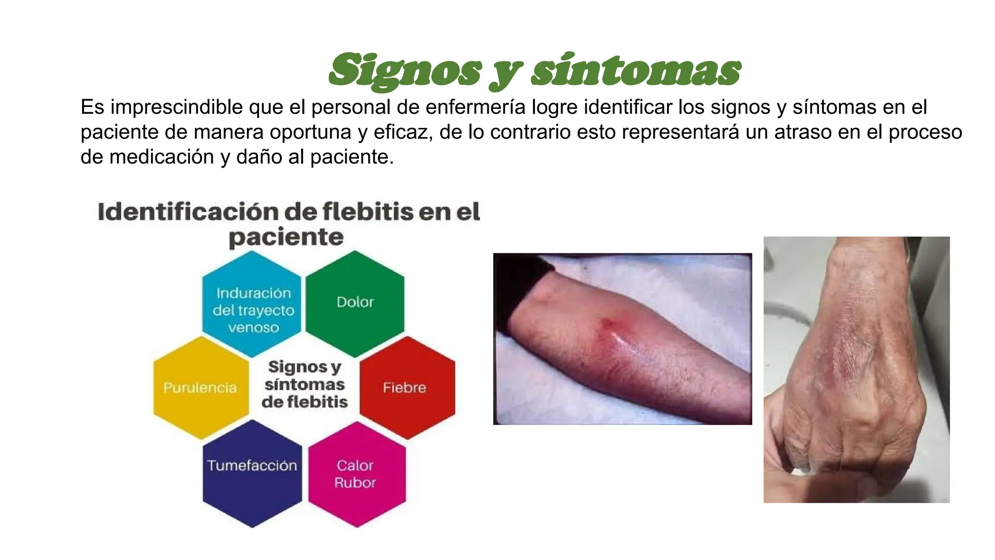 Tipos De Flebitis Y Cuidados De Enfermería Pptx