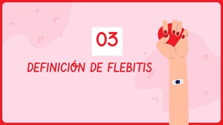 Flebitis Cx.pptx