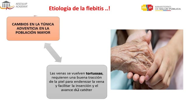 Flebitis QUIMICA, la seguridad en la terapia de infusion HOSPITAL Monte ...