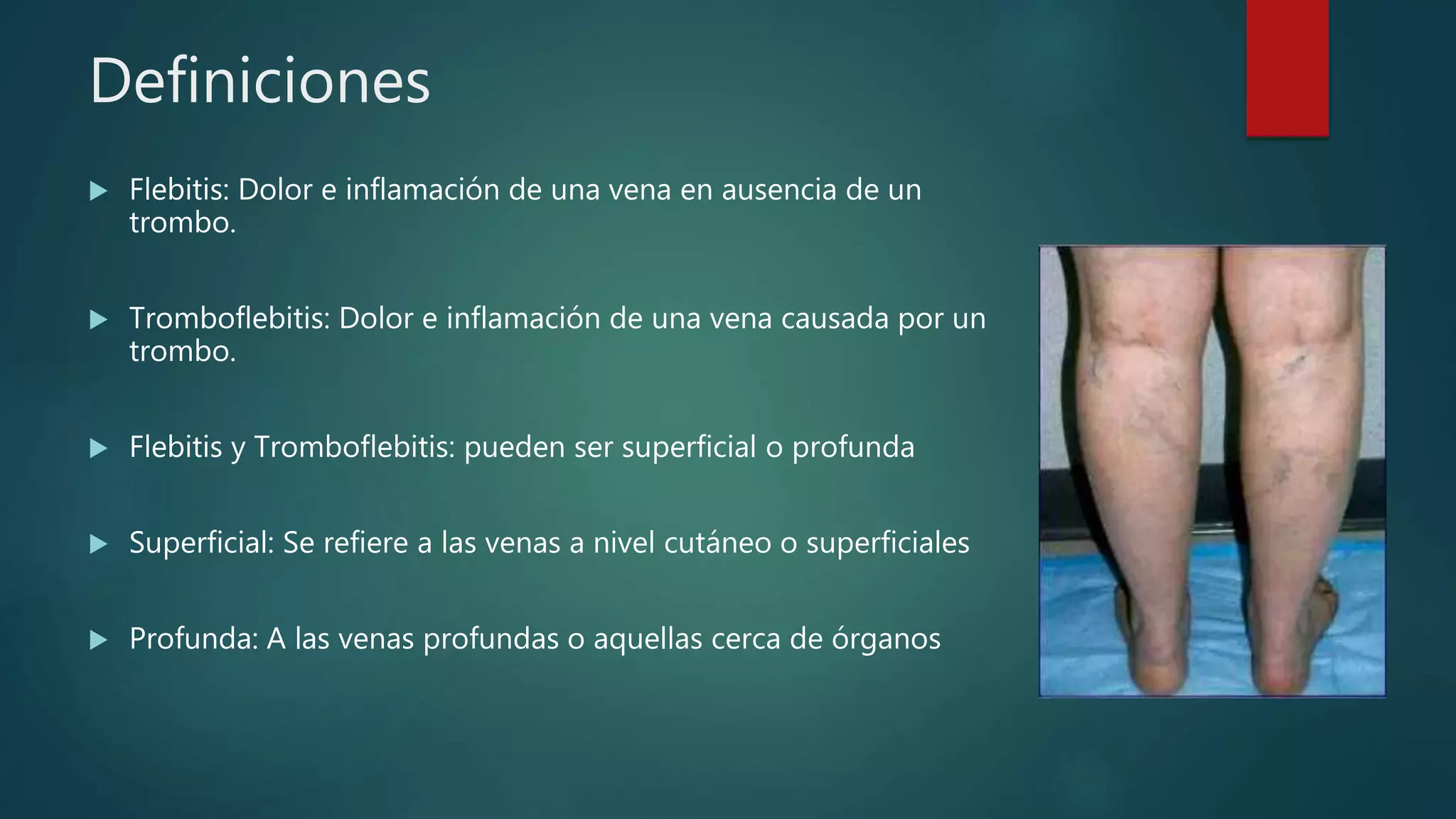 Flebitis superficiales y profundas | PPTX