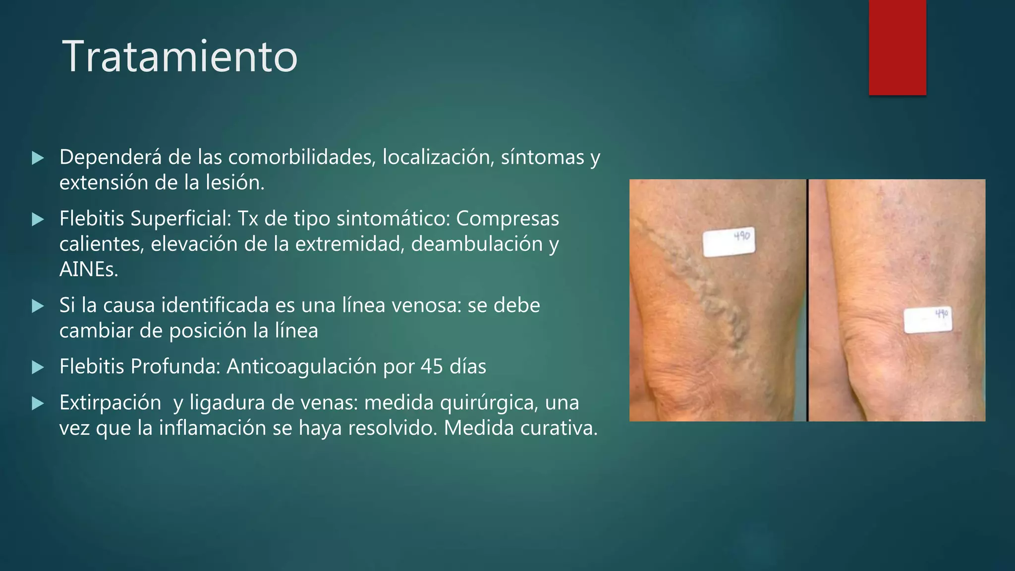 Flebitis superficiales y profundas | PPTX