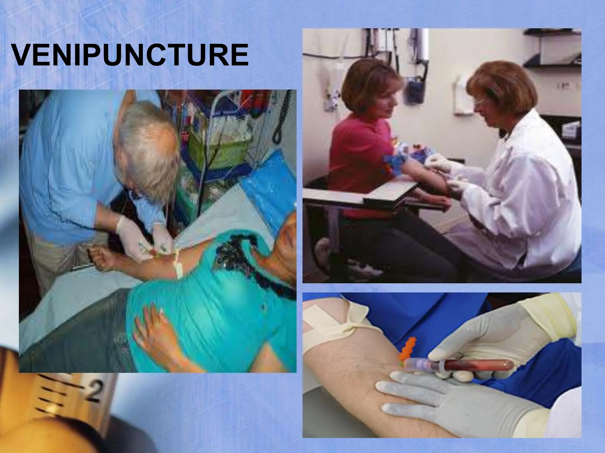 flebotomi.ppt